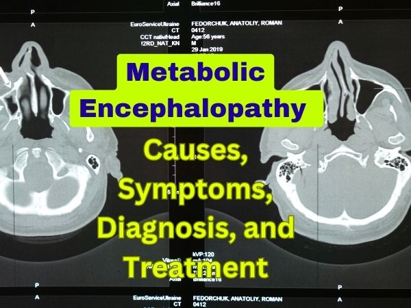 Encephalopathy Symptoms